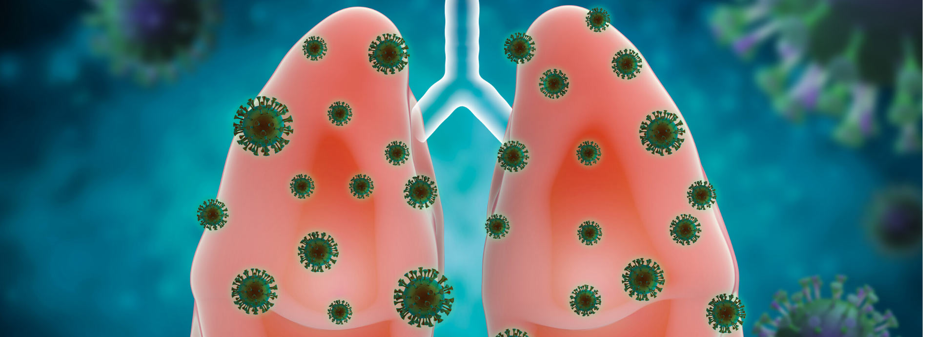 Tests Sérologiques VIDAS-SARS-COV-2: diagnostic de COVID-19