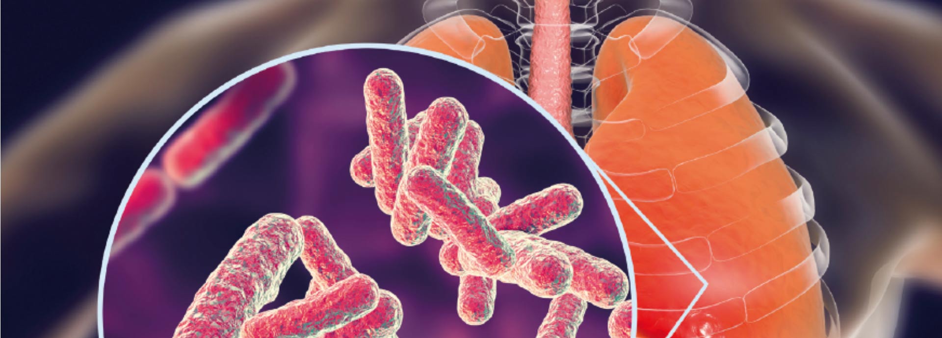 Maladies Infectieuses Syndromiques : identifier les agents pathogènes