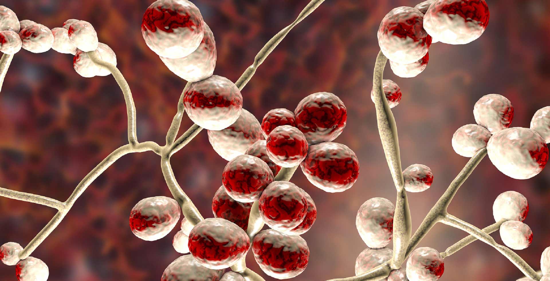 Comment améliorer le diagnostic des infections fongiques