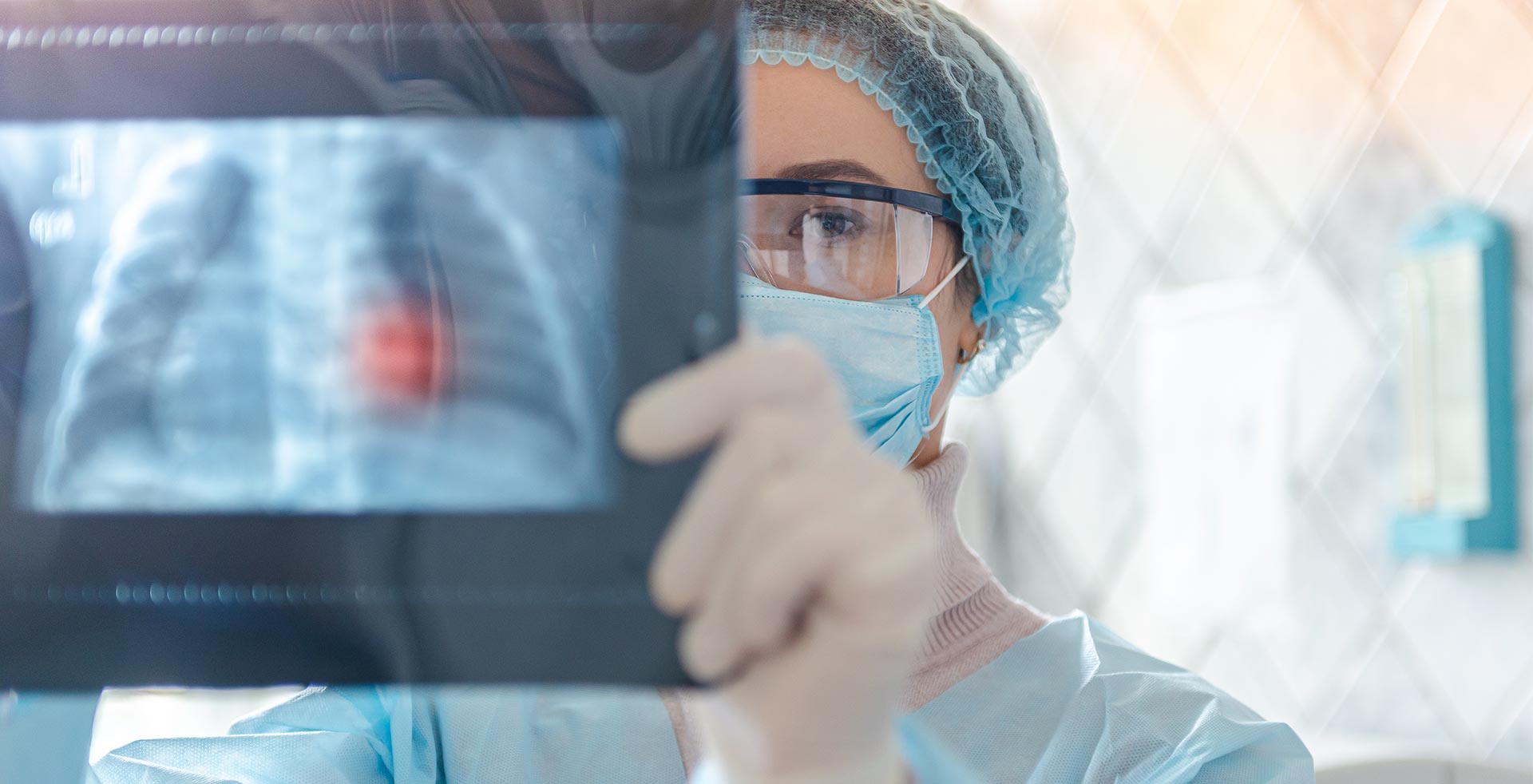 Place de la PCR multiplex dans l’épargne antibiotique des pneumonies ...